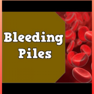 Bleeding Piles Treatment in Nashik | Saru Hospital Nashik